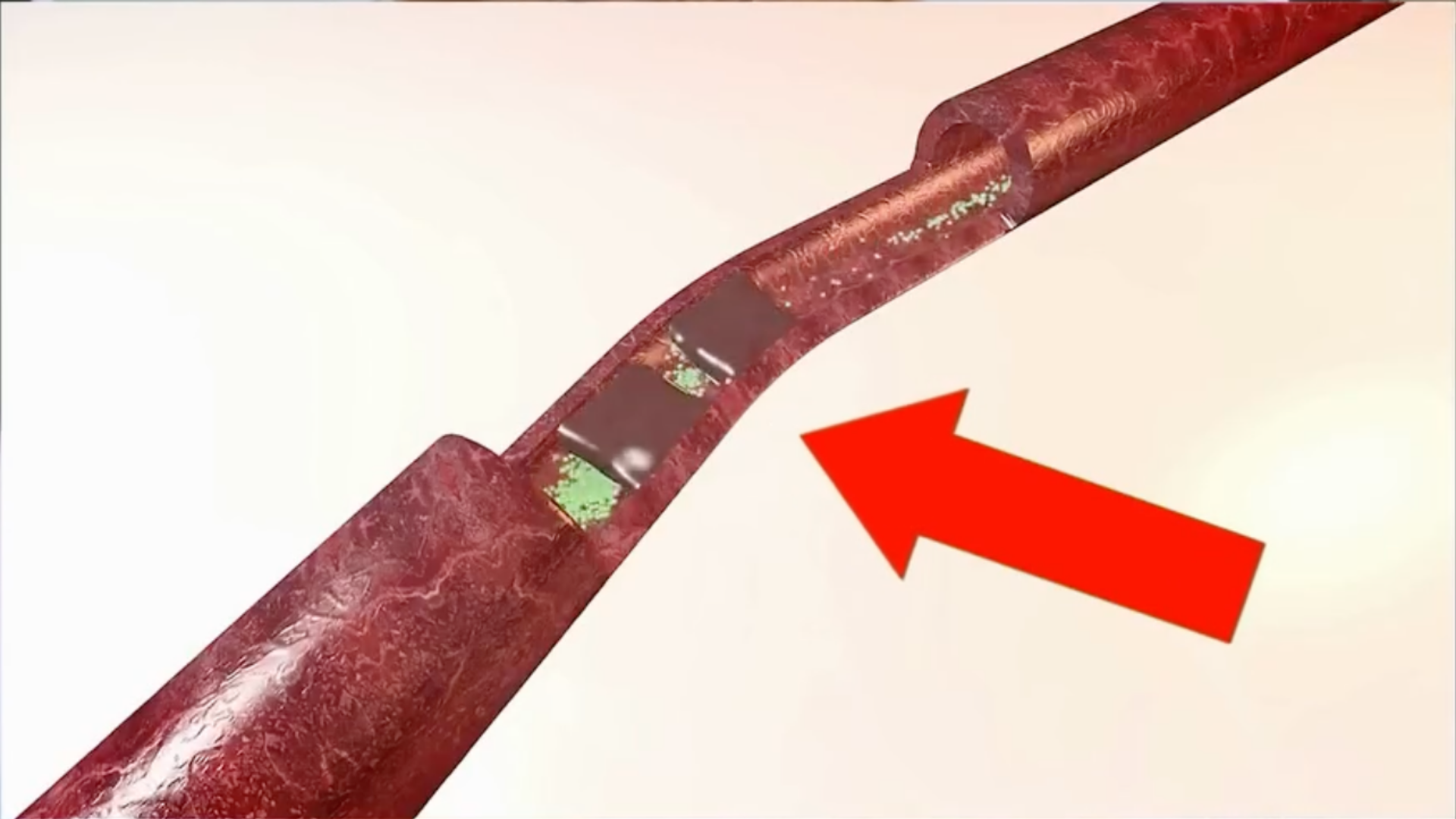 Lisa Hair Success Story - Tricho Labs