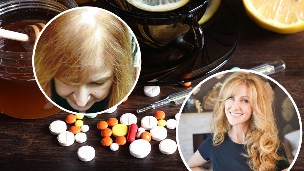 Lisa Hair Success Story - Tricho Labs